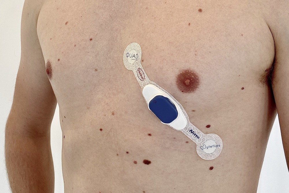 Smart health patch adapts to measure Covid-19 patients - Weartech Design